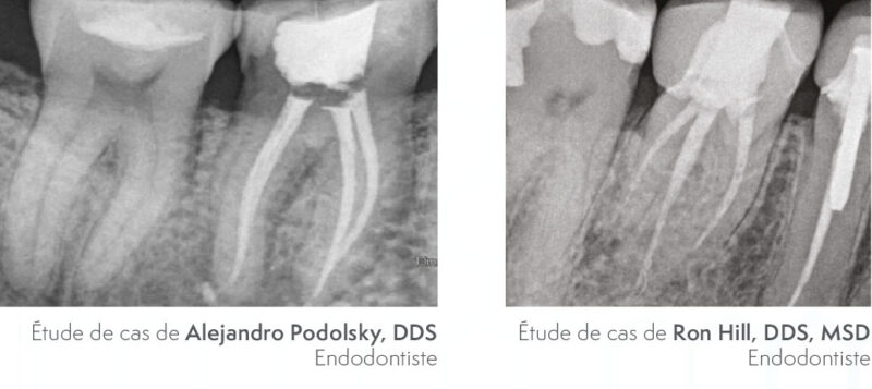 NeoSEALER® Flo - Avalon Biomed